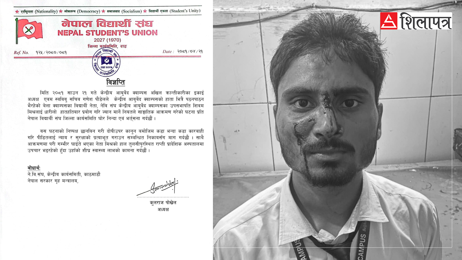 क्याम्पस हाताभित्रै नेविसंघका नेतामाथि धारिलो हतियार प्रहार, स्ववियु ...